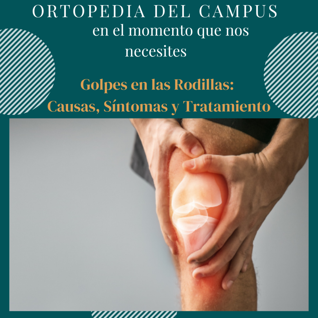 Golpes en las Rodillas: Causas, Síntomas y Tratamiento - Del Campus ...
