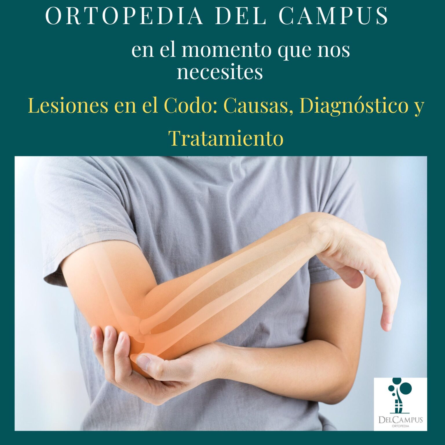 Lesiones en el Codo: Causas, Diagnóstico y Tratamiento - Del Campus ...