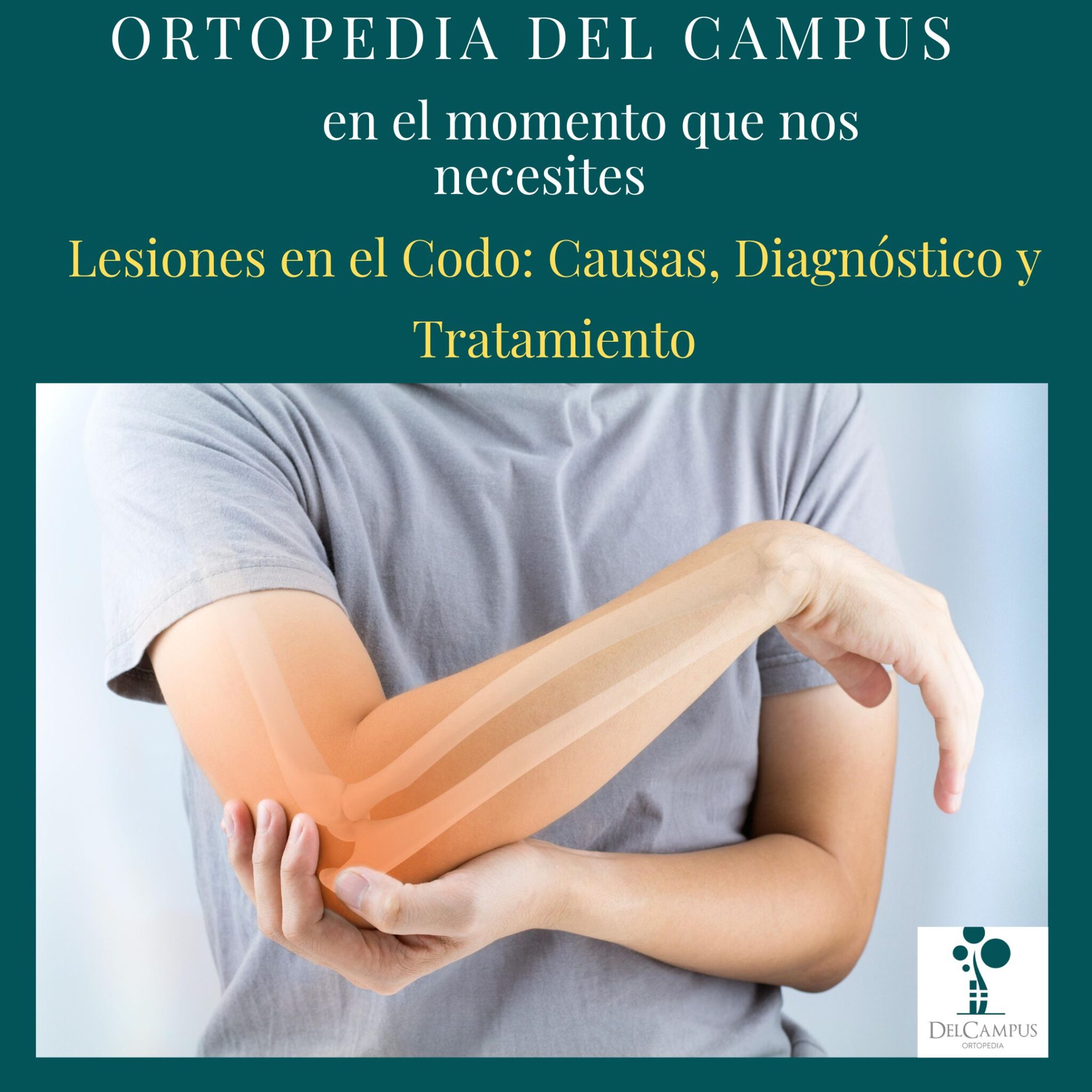 Lesiones en el Codo: Causas, Diagnóstico y Tratamiento - Del Campus ...