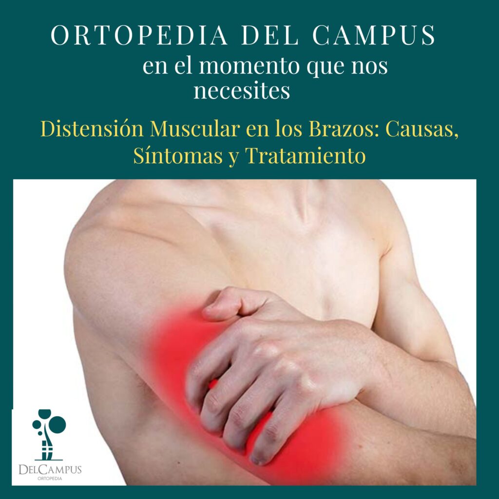 Distensión Muscular en los Brazos: Causas, Síntomas y Tratamiento - Del ...